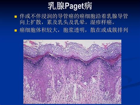 女性生殖系统疾病 The Diseases Of Genital System Ppt Download