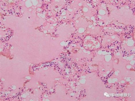 切片学习 常规病理组织切片及诊断要点 知乎