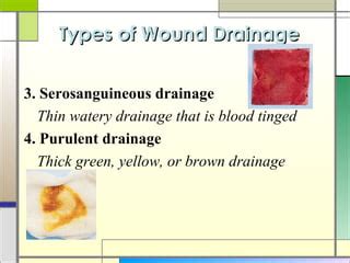 Wound Healing And Care Presentation Ppt
