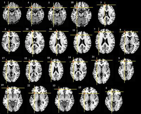 The Axial View Of Slices Of Decision Making Voxels And Crosshairs Are Download Scientific