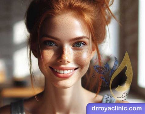 با موثرترین روش درمان کک و مک صورت آشنا شوید کلینیک زیبایی رویایی آبی