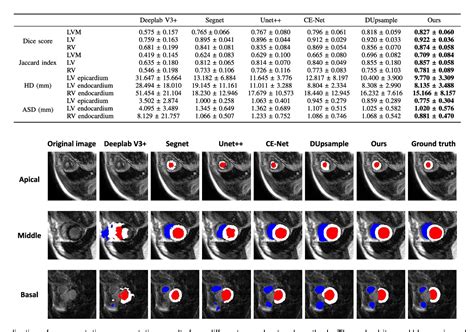 Figure From SK Unet An Improved U Net Model With Selective Kernel For The Segmentation Of LGE