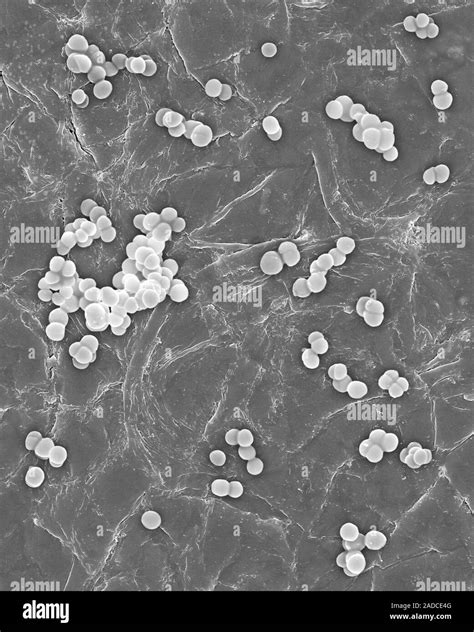 Scanning Electron Micrograph Sem Of Photocomposite Staphylococcus