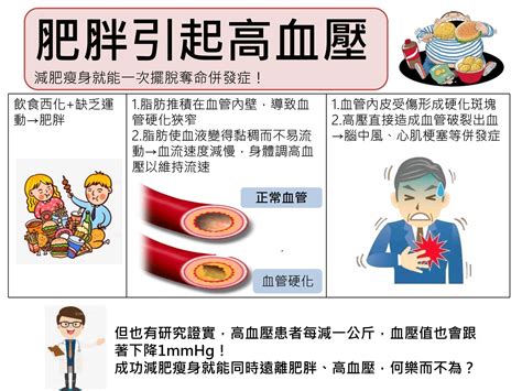 康祐診所 許多高血壓合併體重過重者一聽到減重可以降血壓，第一反應就是：那我來減重就好，成功後就可以不用吃血壓藥了！