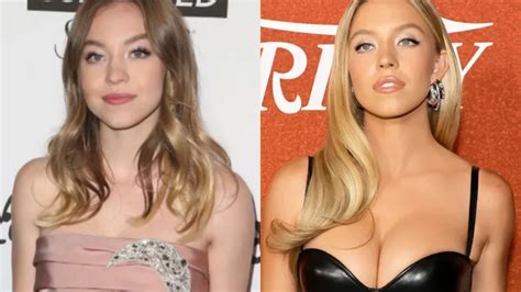 Sydney ‍ ‌‍ ‍‌ ‍ ‌‍ ‍‌ Sweeneys Breast Implants Before And After Lin