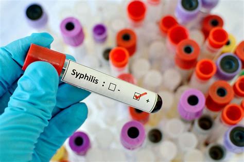 249 Babies Born With Syphilis In Thailand This Year As Many 249 Babies