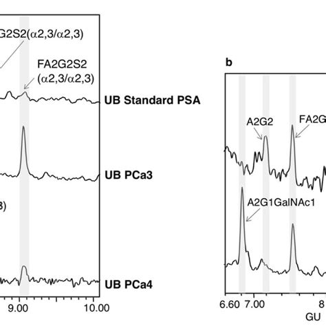 Hilic Uplc Profiles Of Psa N Glycans From Unbound Ub Fractions A