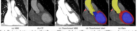 Figure 6 From Structure Driven Unsupervised Domain Adaptation For Cross Modality Cardiac