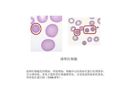 1 常见血液细胞学图谱word文档在线阅读与下载无忧文档