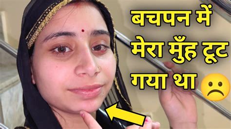 बचपन में सलोनी का मुँह टूट गया था ☹️ Youtube