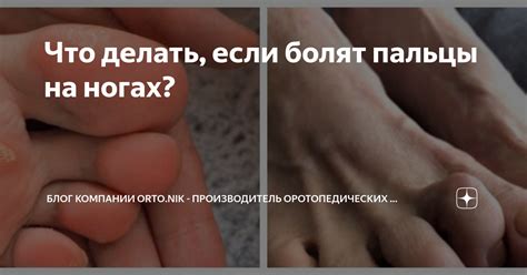 Что делать если болят пальцы на ногах Блог компании Orto Nik