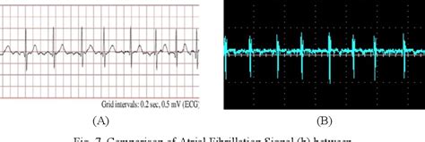 Figure 7 From Development Of Electrocardiogram Signal Generator For