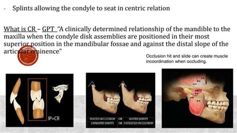 Deprogramming Spilnt 1 Pptx Dental Health Diseases And Conditions