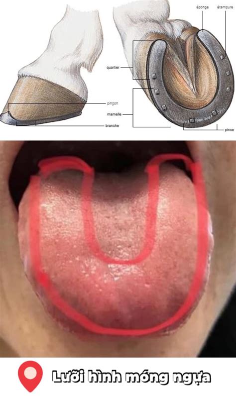 Thiệt Chẩn Hình Móng Ngựa Đông Y Kim Định