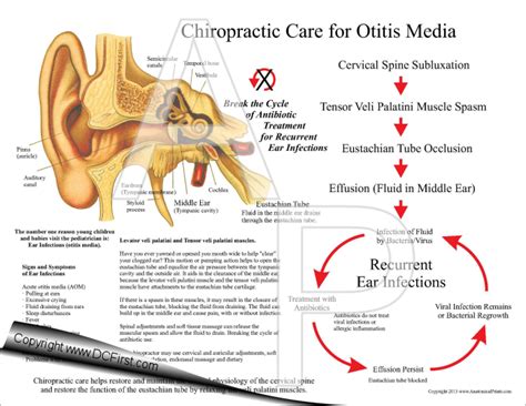 Chiropractic Treatment Of Ear Infections Tear Off Sheetspad