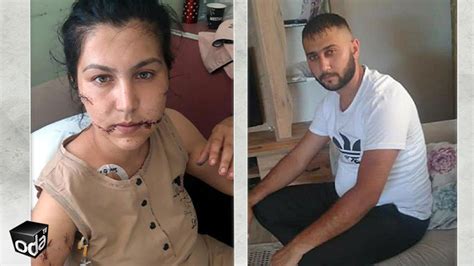 İmam Nikahlı Eşinden Yaşadığı Dehşeti Anlattı Önce Bıçakladı Sonra