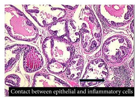 Histological Views Of Prostatic Inflammation Control Group Without Any Download Scientific