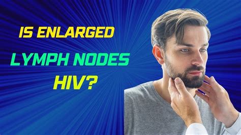 Swollen Lymph Nodes Hiv Positive