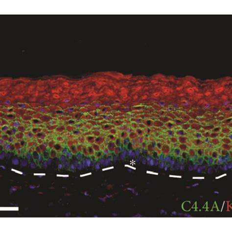 C44a Expression In Relation To Epidermal Differentiation Markers A