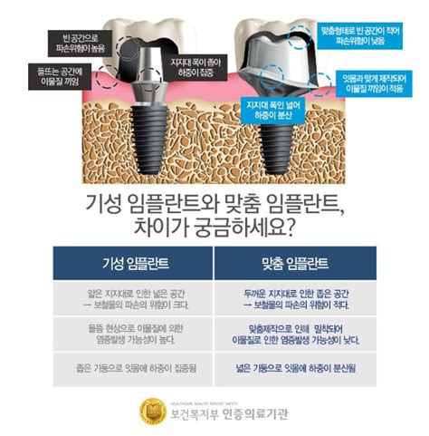 임플란트에 음식물이 껴요 이유를 알려드릴게요 청주1등치과