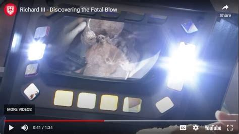 For Want Of A Nail The Kingdom Was Lost English Pathologist Guy Rutty