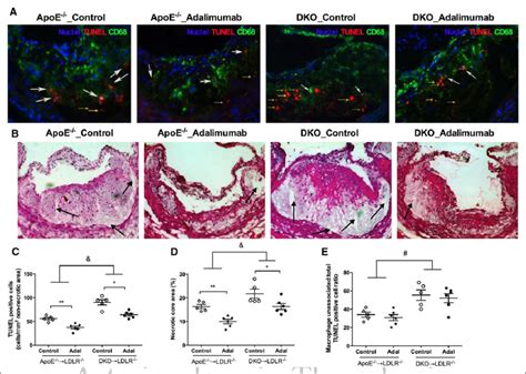 Effects Of Adalimumab On Efferocytosis And Necrosis In Atherosclerotic