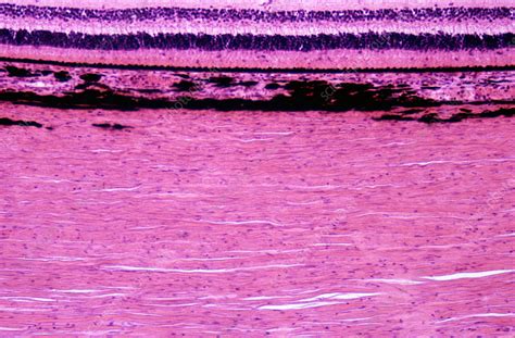 Human Eyeball Layers Light Micrograph Stock Image C0595407