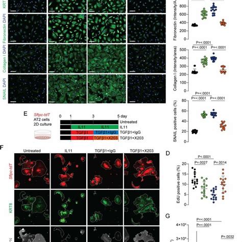 Il11 Signaling In At2 Cells Disrupts At2 To At1 Differentiation After