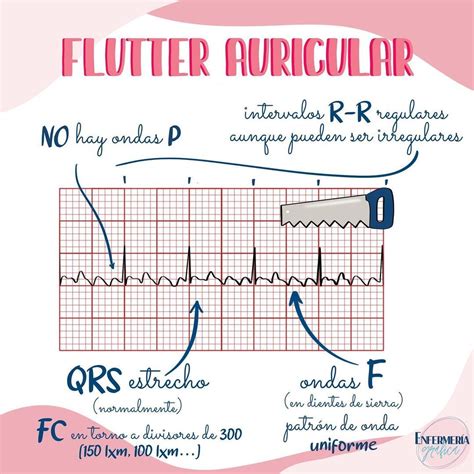 Pin en Cardiología