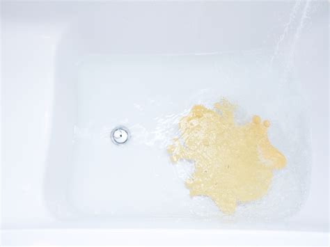 How To Get Permanent Marker Sharpie Off Skin