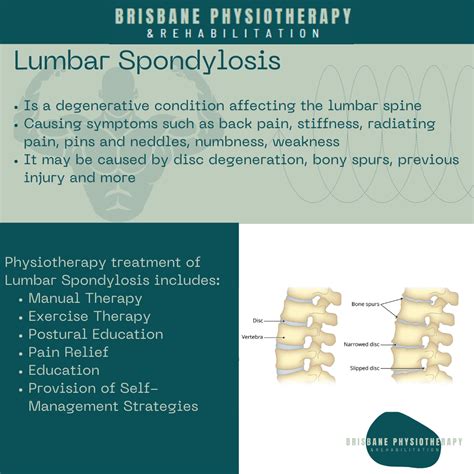 What Is Lumbar Spondylosis Brisbane Physiotherapy And Podiatry