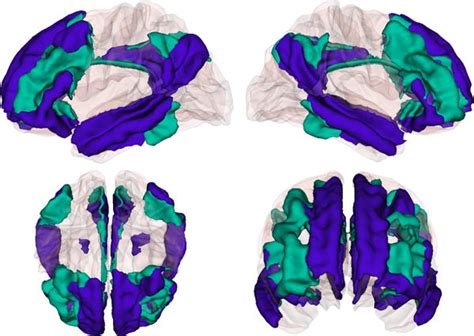 Graph Theoretical Approaches Towards Understanding Differences In Frontoparietal And Default