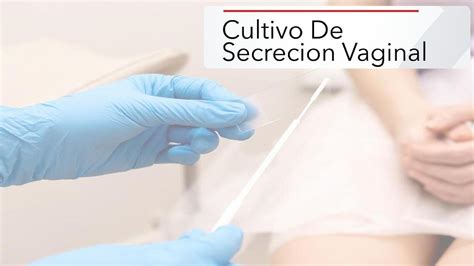 Secrecion Vaginal Jesús Aldana Custodio Udocz