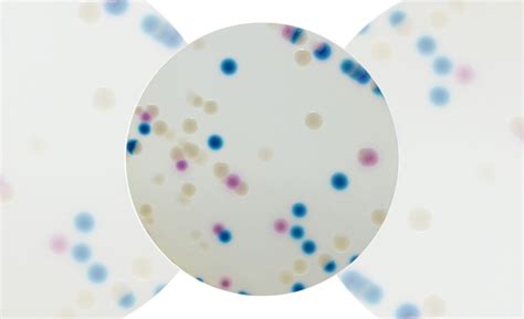 Selective Growth Of Colistin Resistant Bacteria On Chromagar