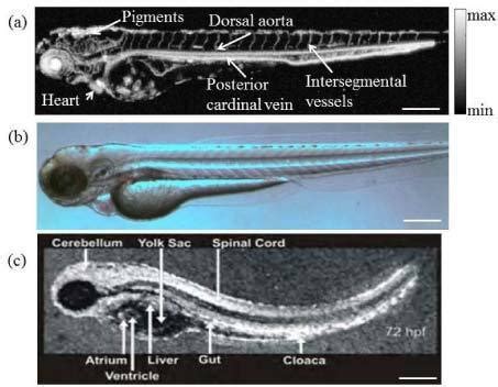 Imaging Of Zebrafish Larvae In Vivo A Whole Body MAP Open I