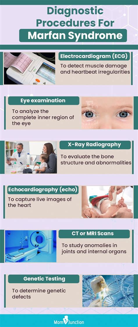 Marfan Syndrome In Babies Symptoms Risks And Treatment