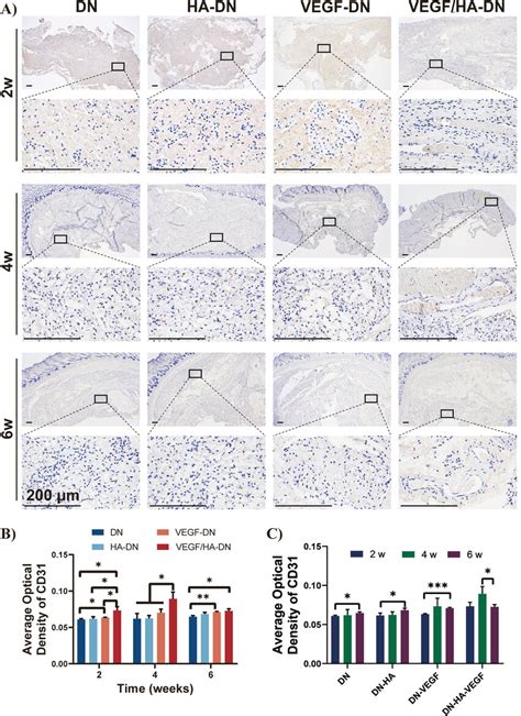Expression Of The Angiogenic Protein Cd31 A Immunohistochemical