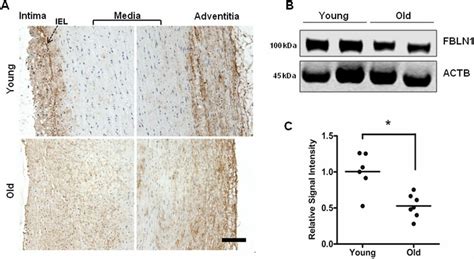 Fibulin 1 Tissue And Protein Distribution In Young Versus Older Donor