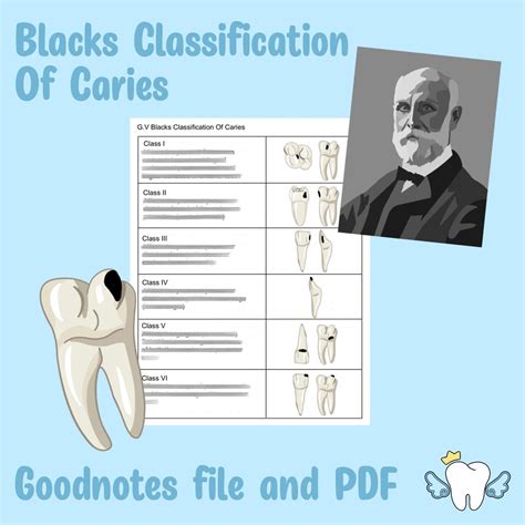 Blacks Classification Of Caries Dental Notes Dental Assisting Study