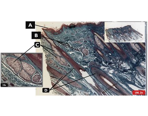 Thin Hairy Skin Histology Quiz