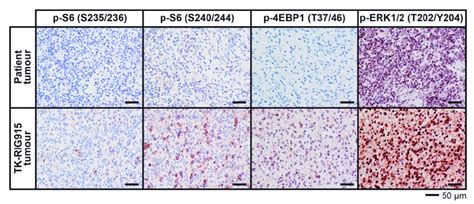 Downstream Effectors Of The Pi3kaktmtor And Rasrafmekerk Pathways