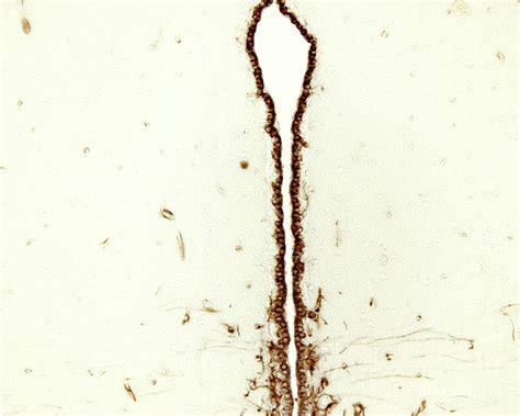 Ependymal Cells Photograph By Jose Calvo Science Photo Library Fine