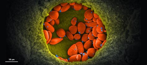 Unprecedented Glimpse Into 15 Million Year Old Rainforest Microscopy