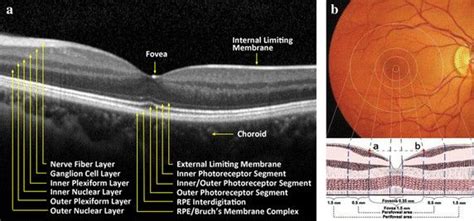 Different Retinal Layers In Oct Eye Anatomy Optical Coherence