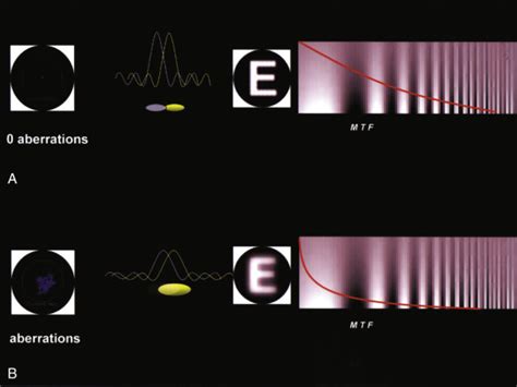 Wavefront Analysis Ento Key