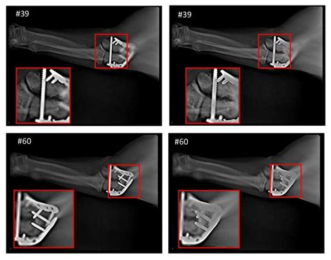 Left Column Reconstruction Slices Of The Bone And Soft Tissue Without