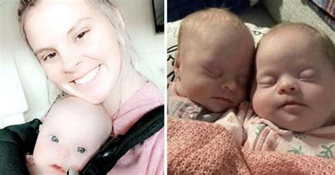 The Special Journey Of Savannah And Her Twins With Down Syndrome El