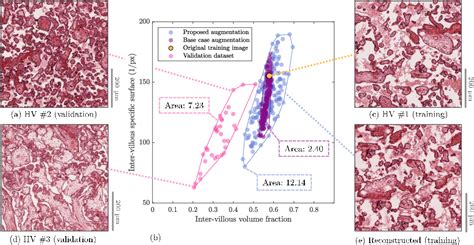 Figure 1 From Automated Segmentation And Morphological Characterization