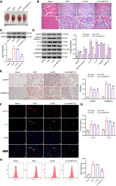 The Mettl3 M6a Reader Protein Ythdf1 Regulates Endothelial Cell Pyroptosis By Enhancing Nlrp3