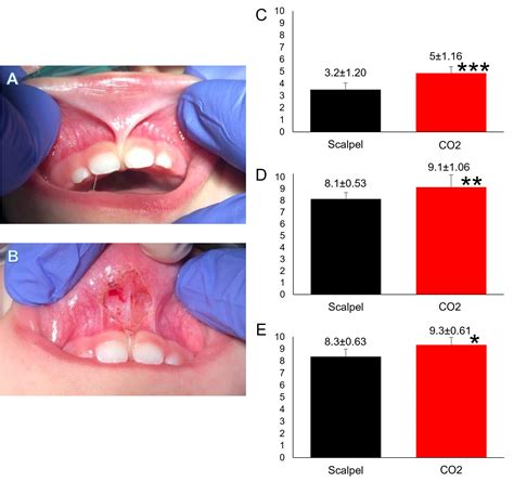 Journal Of Clinical Pediatric Dentistry Jocpd
